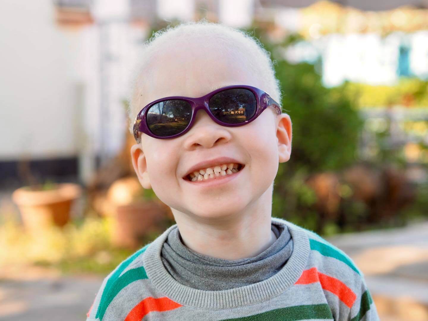 International Albinism Awareness Day Kasisi Foundation